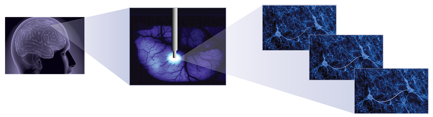 Azadeh Yazdan receives $3.2M grant to investigate ways neurotechnology ...